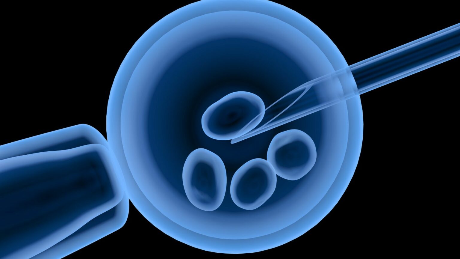 IVF Explained: Your Thorough Guide to the In Vitro Fertilization ...